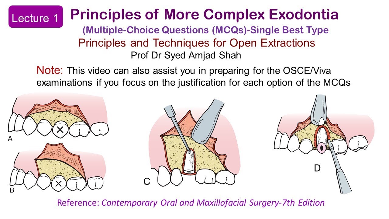 Lecture 1 MCQs | Principles and Techniques for Open Extractions ...