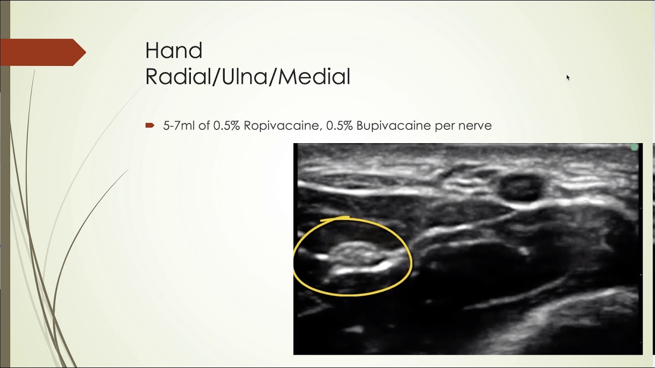 Peripheral Nerve Blocks in the ED - YouTube
