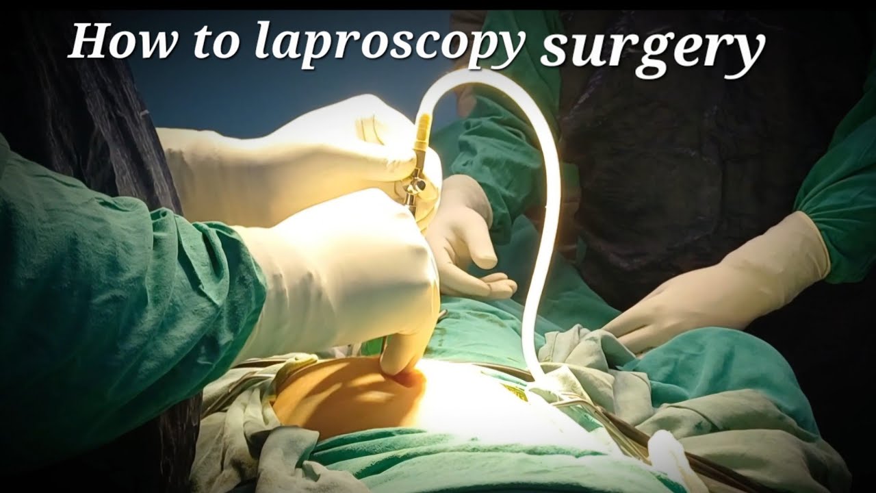 😱Laparoscopic Removal of Uterus or Laparoscopic Hysterectomy with# ...