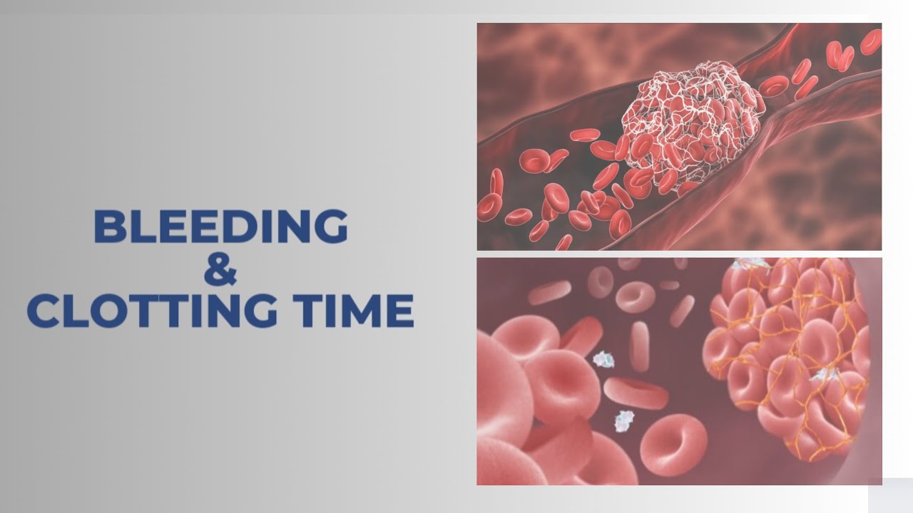 Hemostasis Assessment: BLEEDING AND CLOTTING TIME - YouTube