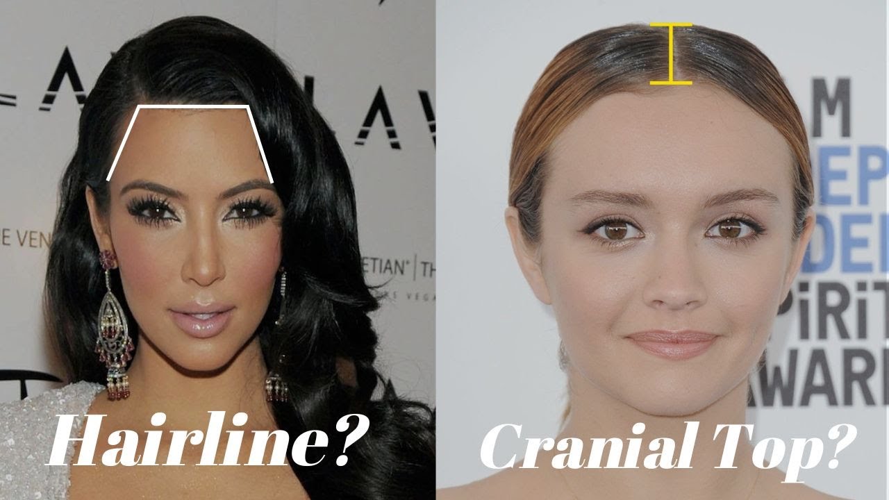 How does Hairline & Cranial Top affect Hairstyles? - YouTube
