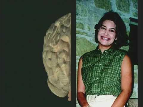 Read 180: Your Brain Exposed - YouTube