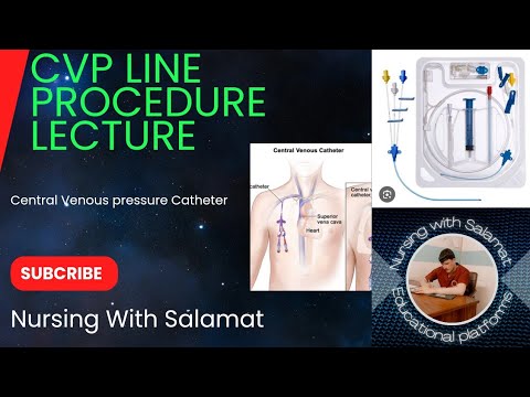CVP line pass Lecture for medical students | central venous pressure #viral - YouTube