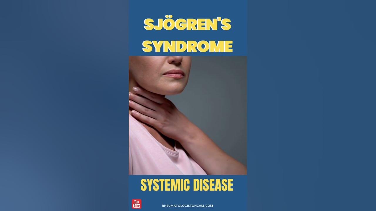 Sjogrens A Systemic Disease Signs And Symptoms Sjogren Sjogrens Autoimmunedisease Youtube