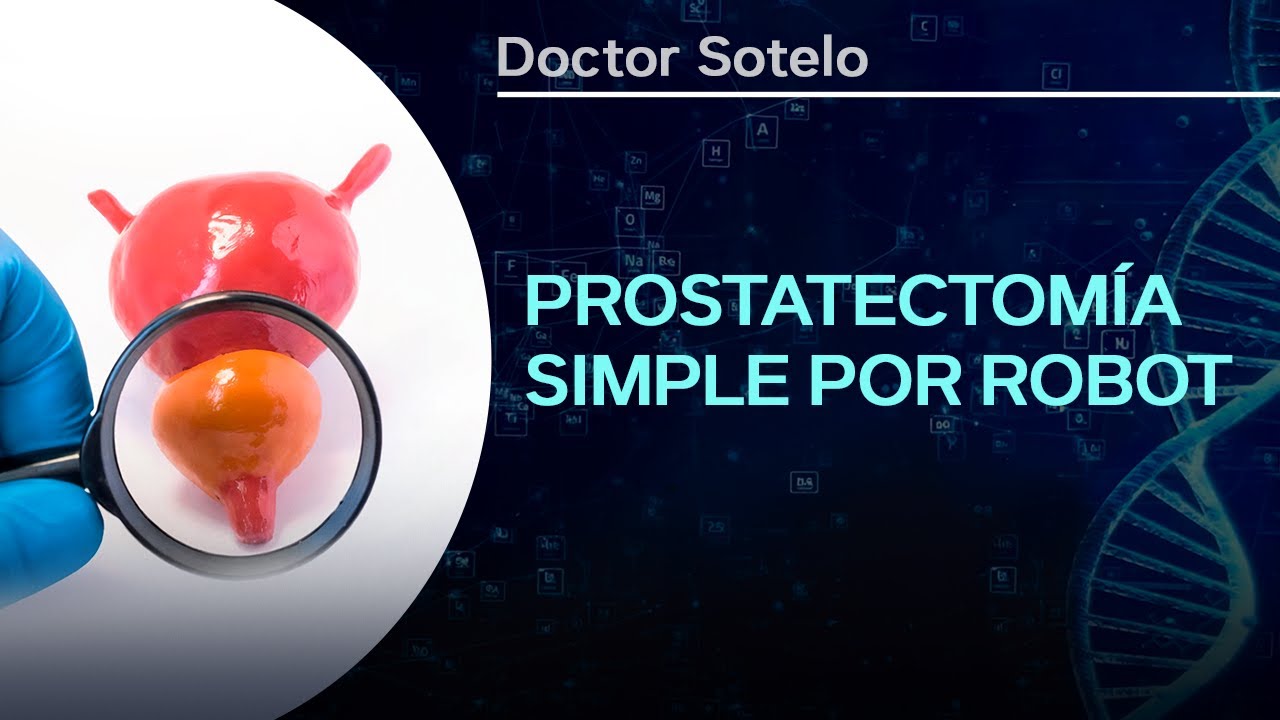 Técnica de prostatectomía simple por robot - YouTube