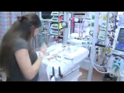 Surgeons saved the life of a baby heart beating outside of her chest ...