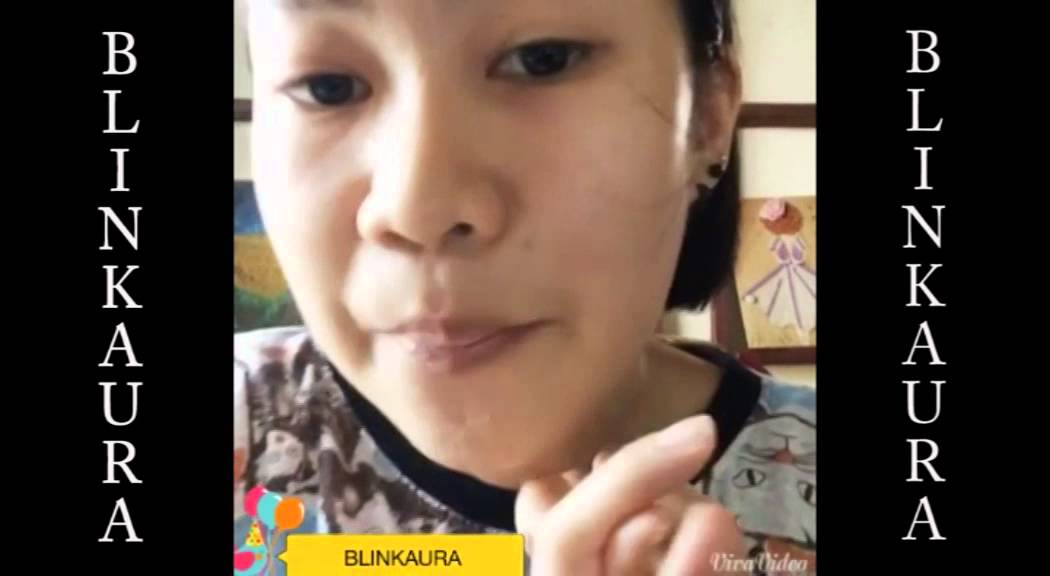 วิธีแต้มกรดTCA By BLINKAURA - YouTube