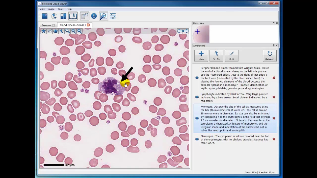 Module 2 Peripheral Blood Smears - YouTube