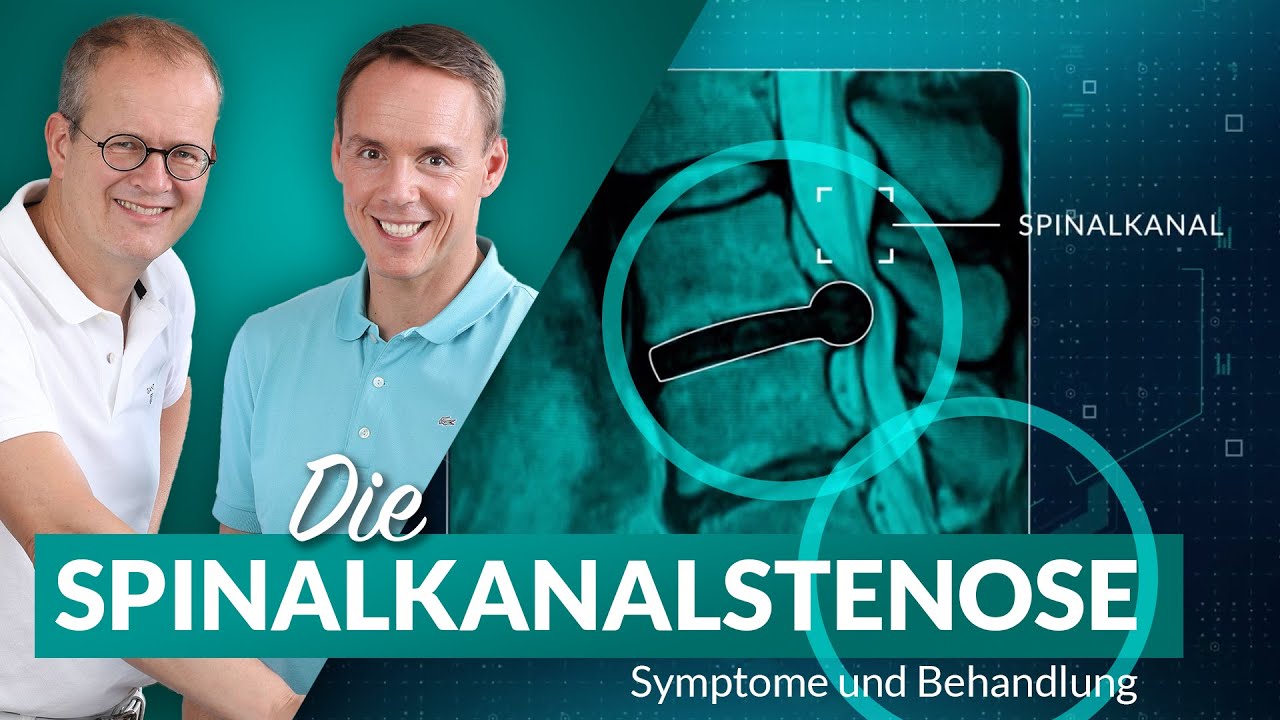 Die Spinalkanalstenose (Symptome und Behandlung)- Wirbelsäulenzentrum ...