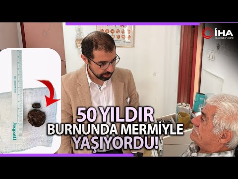 Burnundan Giren Kurşun 50 Yıl Sonra Çıkartıldı