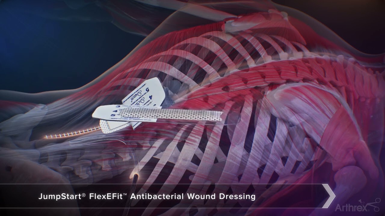 JumpStart® FlexEFit™ Antibacterial Wound Dressing - YouTube