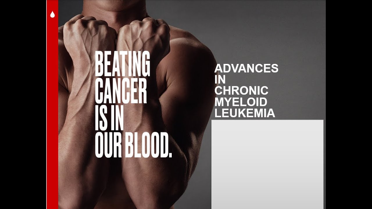 Advances in Chronic Myeloid Leukemia Alison Wakoff Loren - YouTube