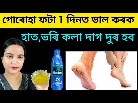 এদিনত গোৰোহা ফটা,হাত, ভৰি ফটা, শুকান ছাল দুৰ হব ছাল বগা উজ্বল হব জিলিকি উঠিব ।।