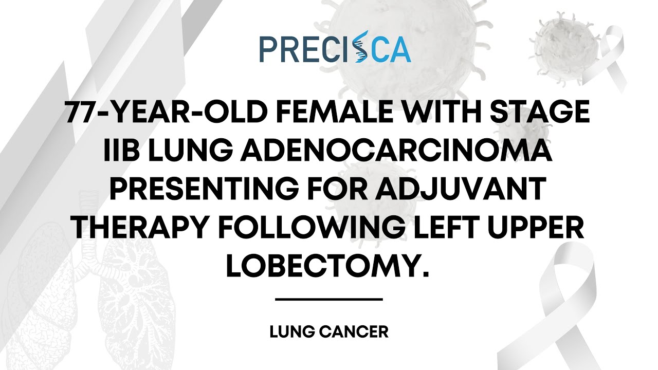 Expert Cancer Panel: Stage IIB lung adenocarcinoma presenting for ...