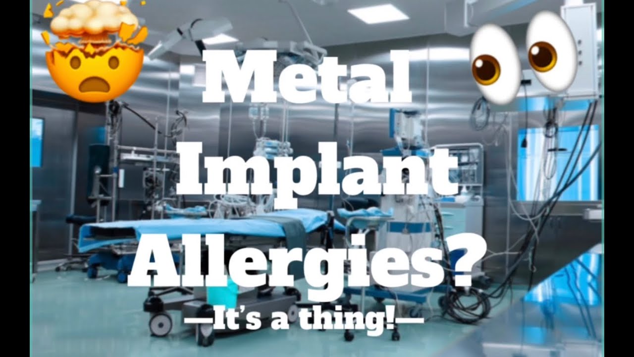 METAL IMPLANT ALLERGIES??? (It's a THING!) - YouTube