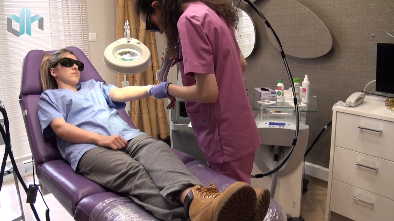 Αποτρίχωση με Laser Αλεξανδριτη Candela Pro - YouTube