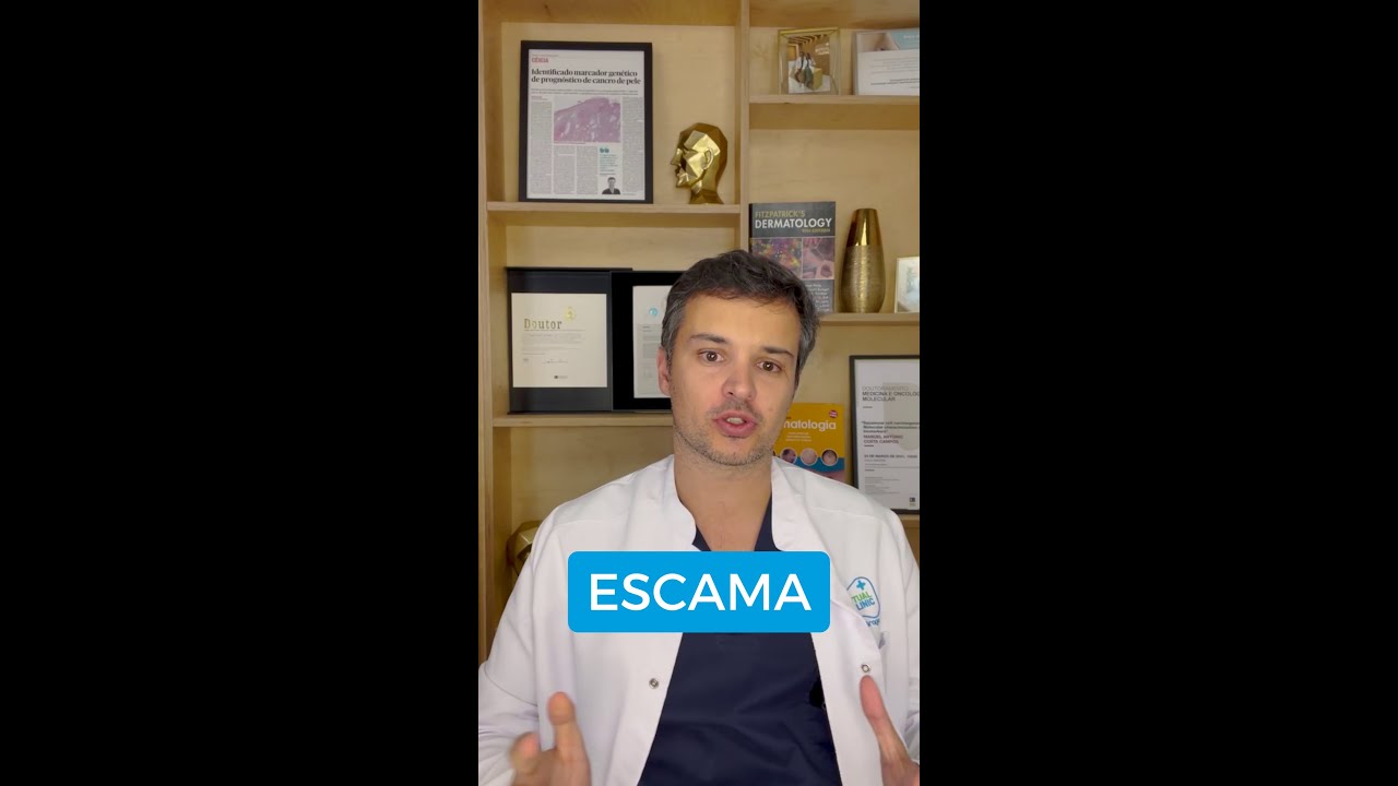 COMO IDENTIFICAR ESCAMAS NA PELE - YouTube