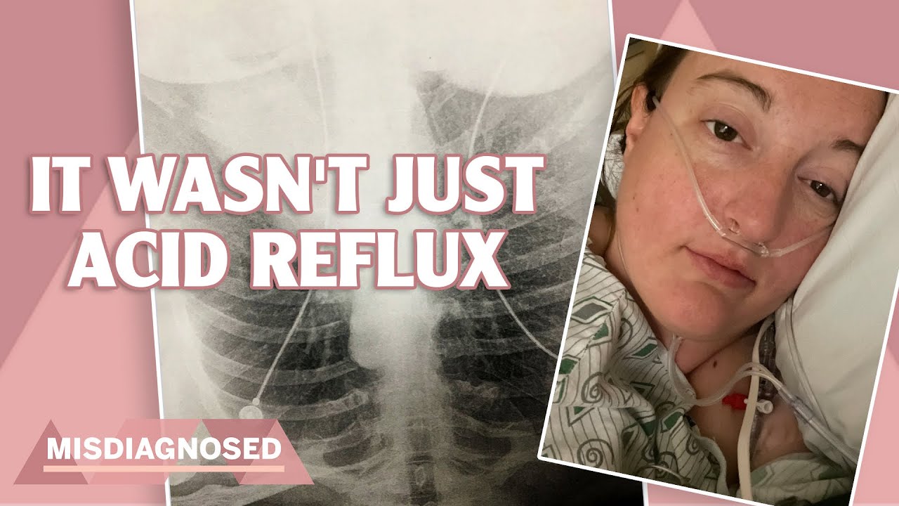 Doctors Dismissed Me And Said It Was Acid Reflux | Misdiagnosed ...