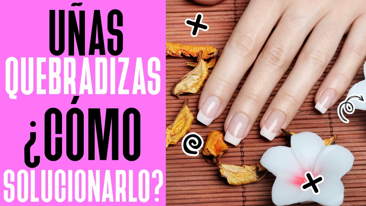 UÑAS CON HONGOS | UÑAS QUEBRADIZAS CAUSAS - YouTube