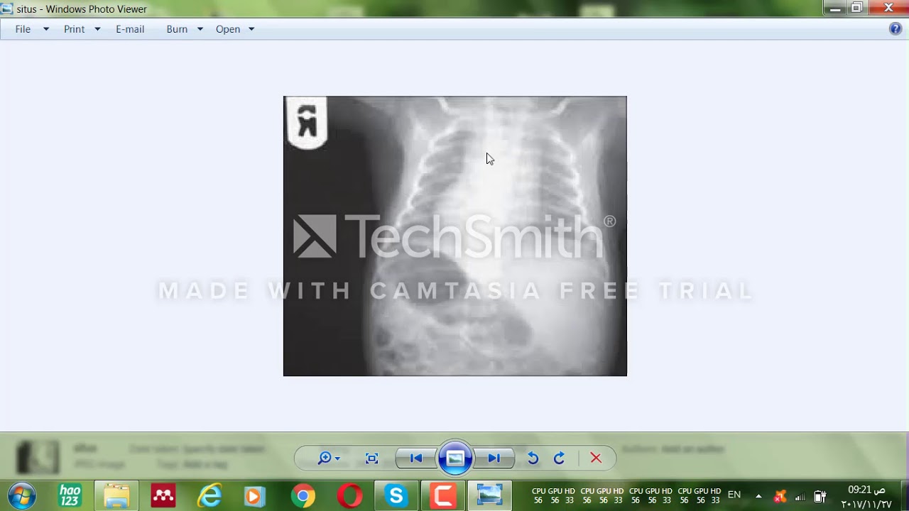 Pediatrics X-RAY - YouTube