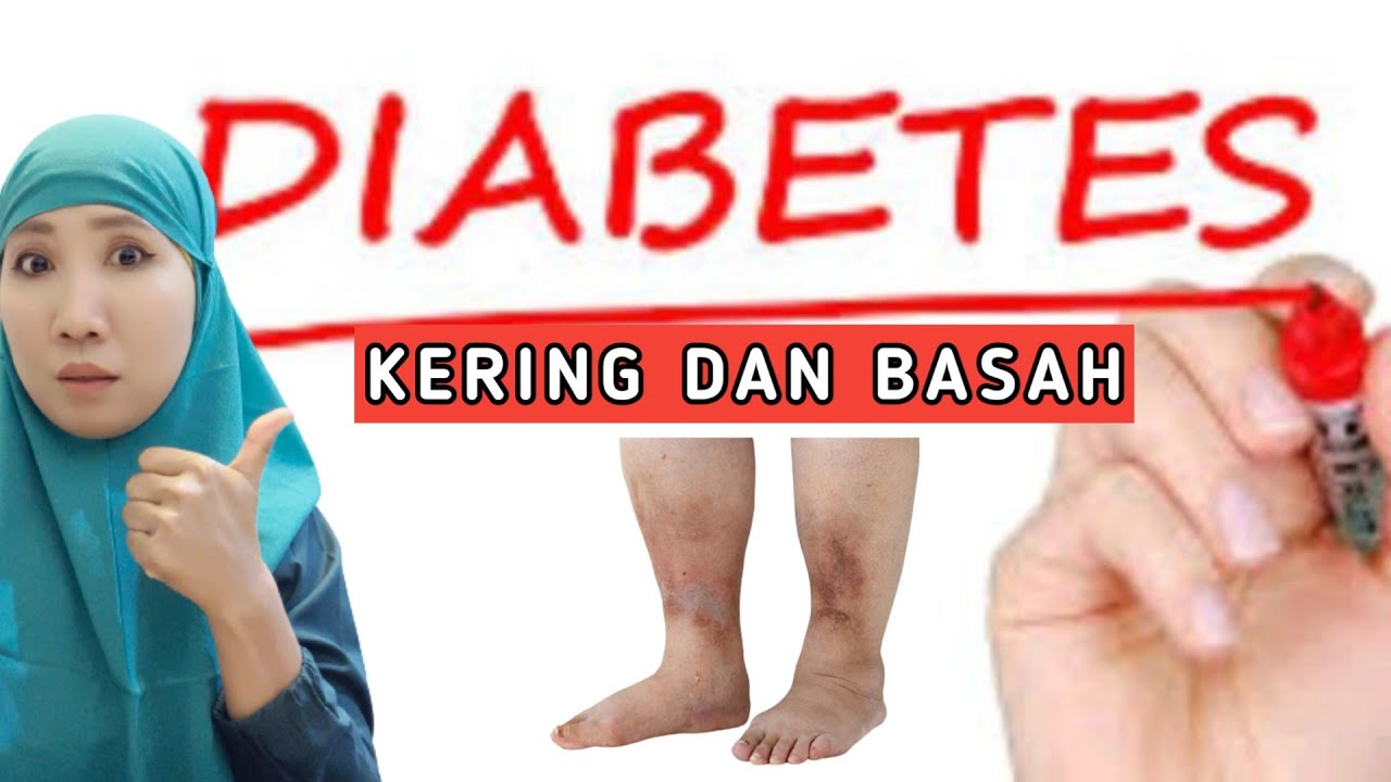 DIABETES KERING vs DIABETES BASAH || Apa Bedanya ya⁉️ - YouTube