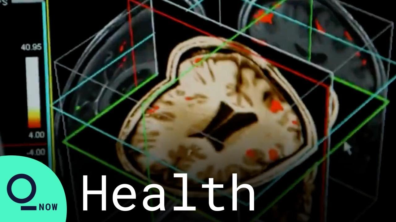 Biogen’s FDA Victory Could Bring Major Changes to Alzheimer’s Treatment ...