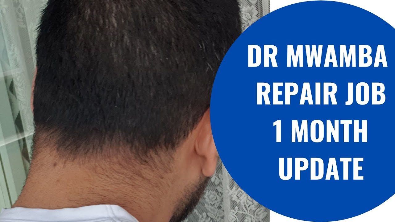 Dr Mwamba Repaired My Donor? - 1 Month Update - YouTube
