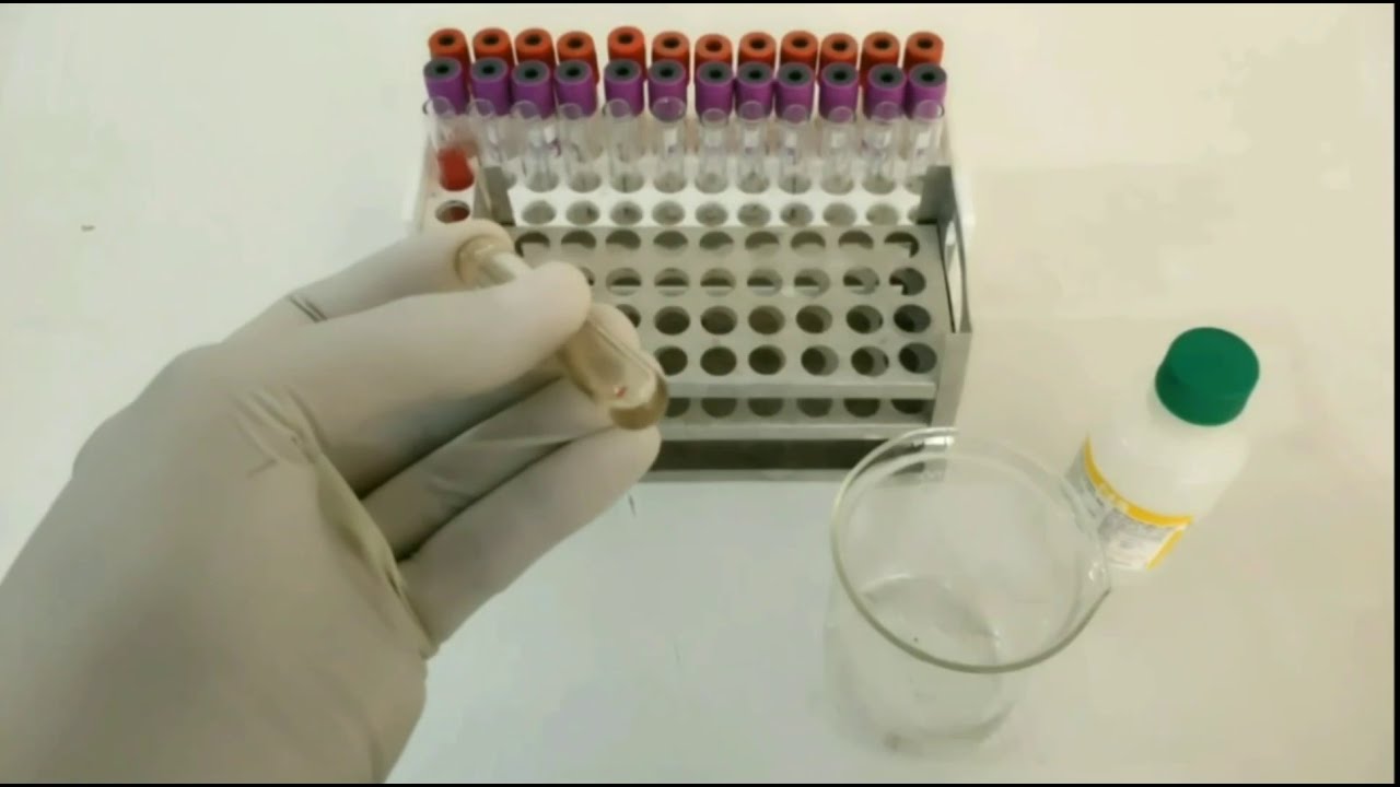 How to confirm Rh negative blood | Du testing || Du Factor || Du ...