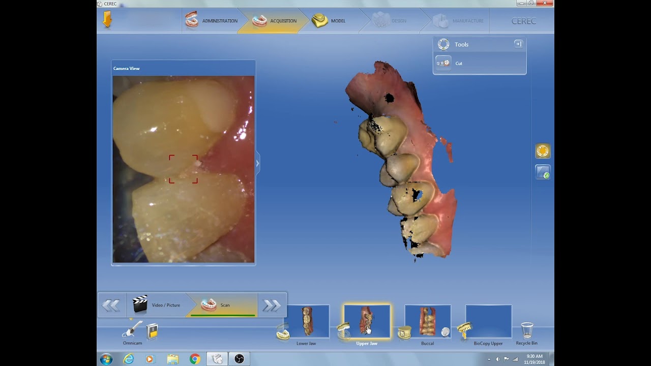 CEREC Scanning Video - YouTube