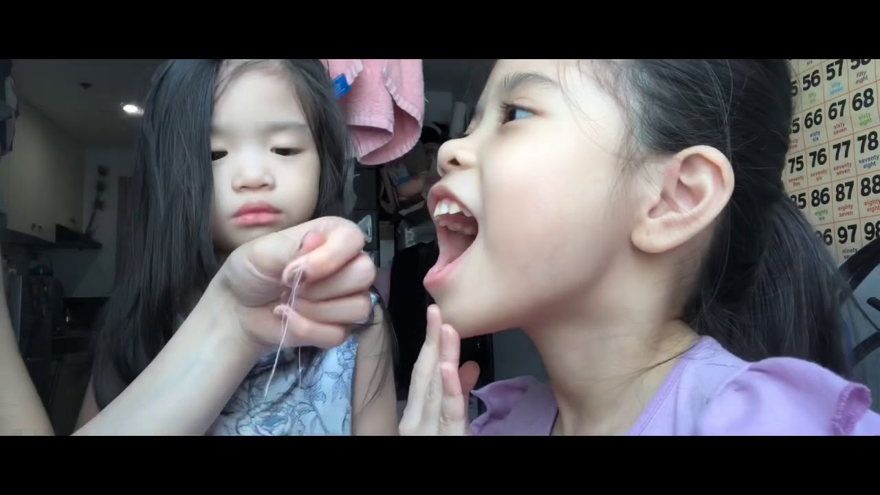 DiY tooth extraction 😅 - YouTube