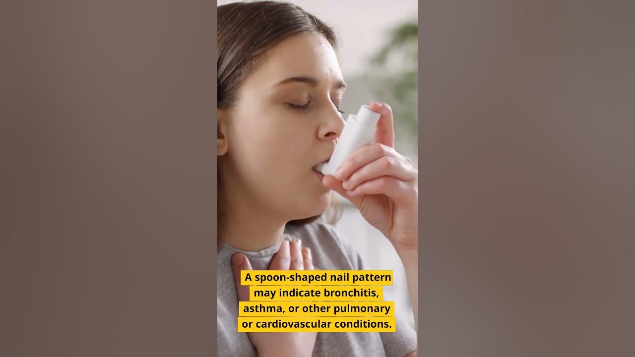 5 Health Related Things Your Nails Can Tell You #shorts - YouTube