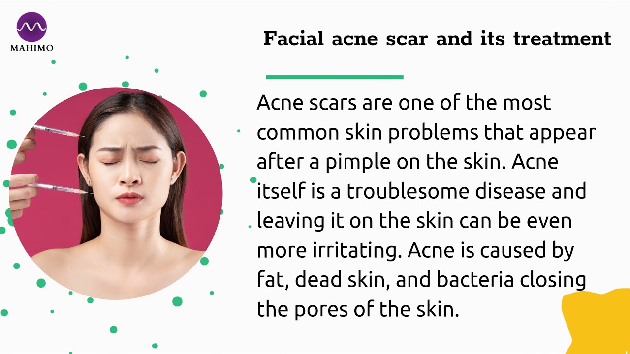 Facial scar treatment | Types and the source of scars + the best ...
