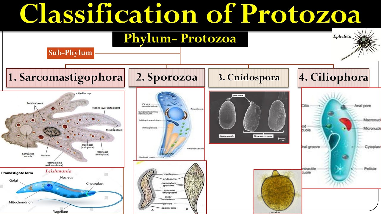 Classification Of Protozoa Lesson Explainer: Kingdom Protista | Nagwa Classification Of Protozoa Lesson Explainer: Kingdom Protista | Nagwa