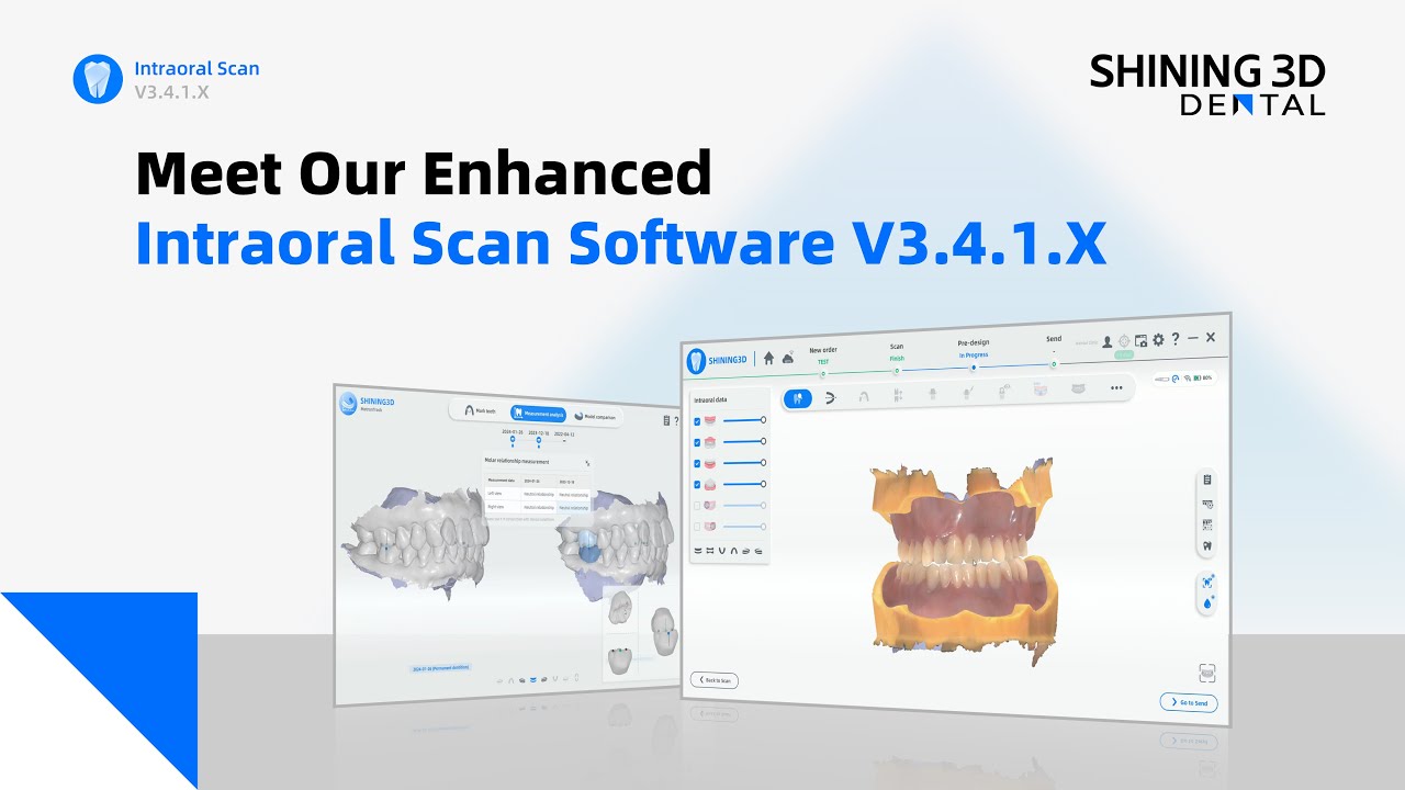 Meet Our Enhanced Intraoral Scan Software V3.4.1.X - YouTube