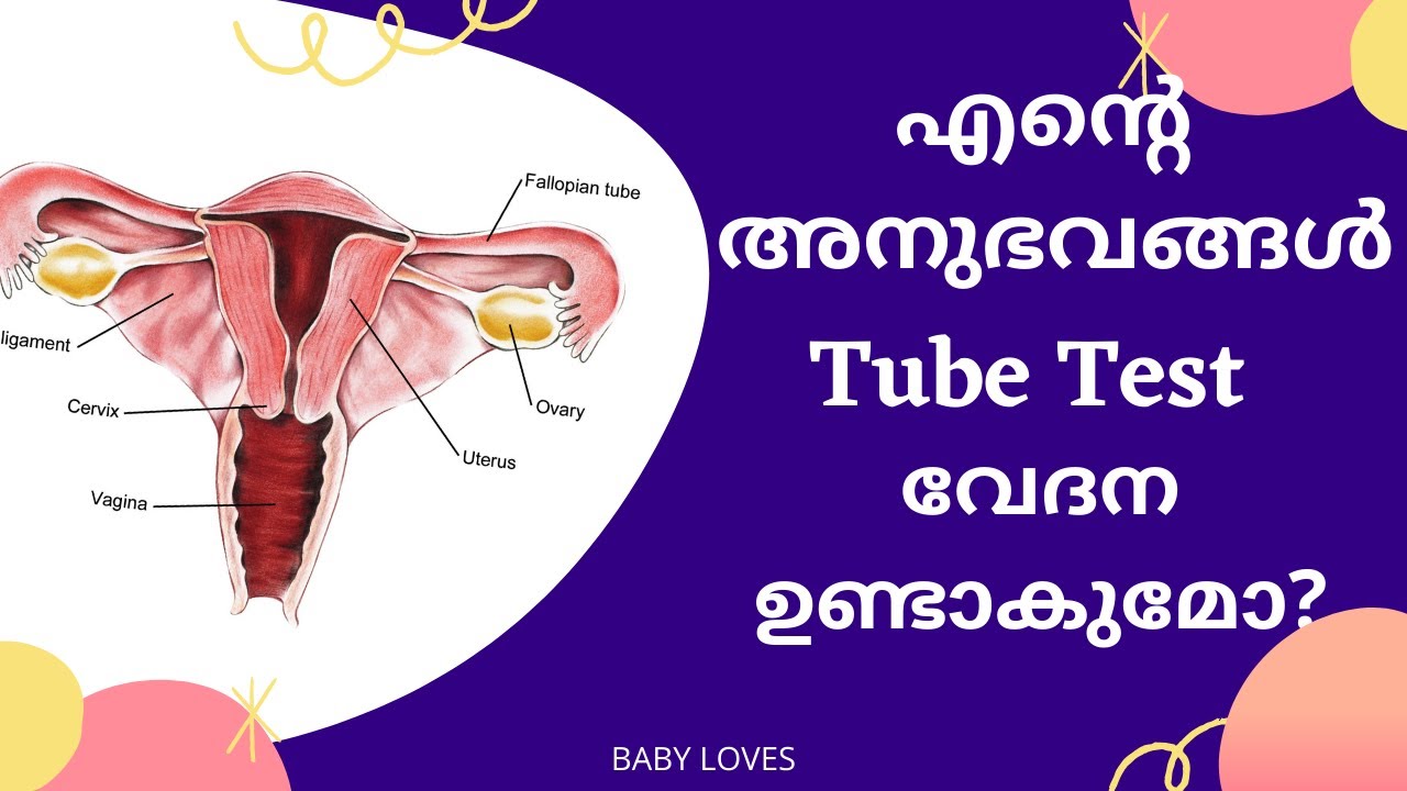 What Is Tube Test||Tube Test Stories||Tubal Pregnancy|| HSG Test||Baby ...