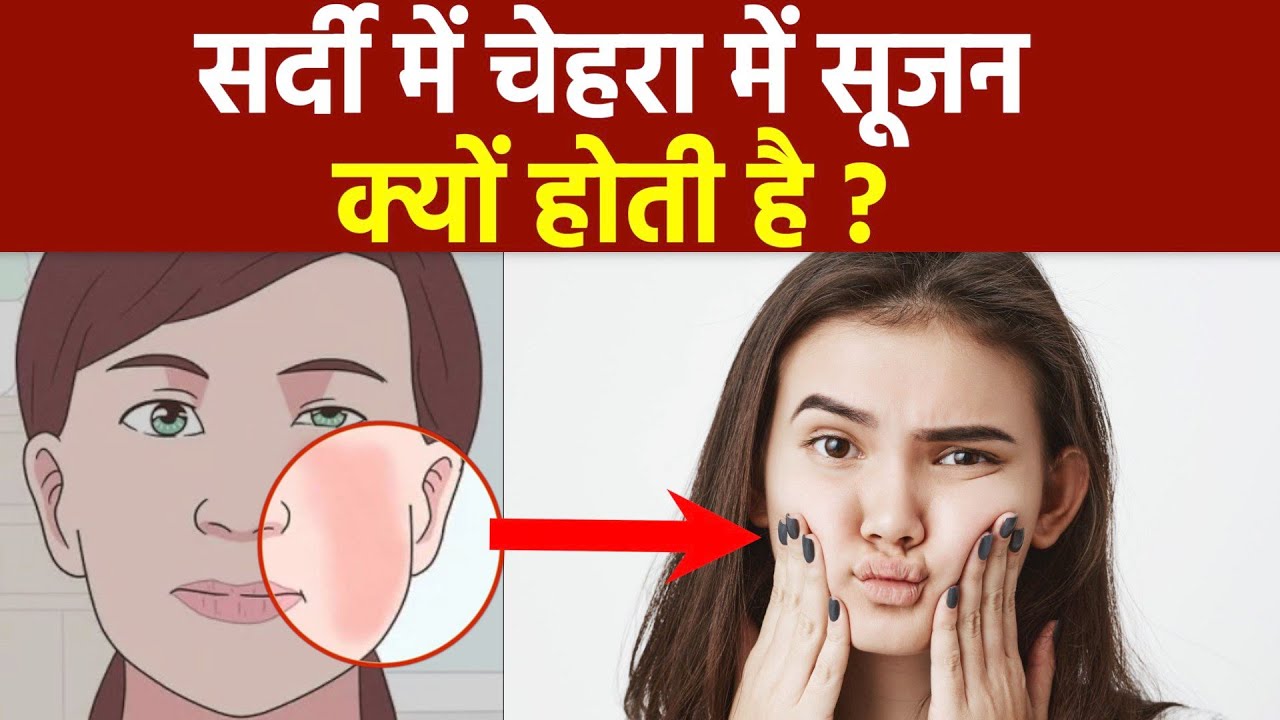 Face Swelling In Winter: Sardi Me Chehra Fulne Ka Kya Karan Hai ...