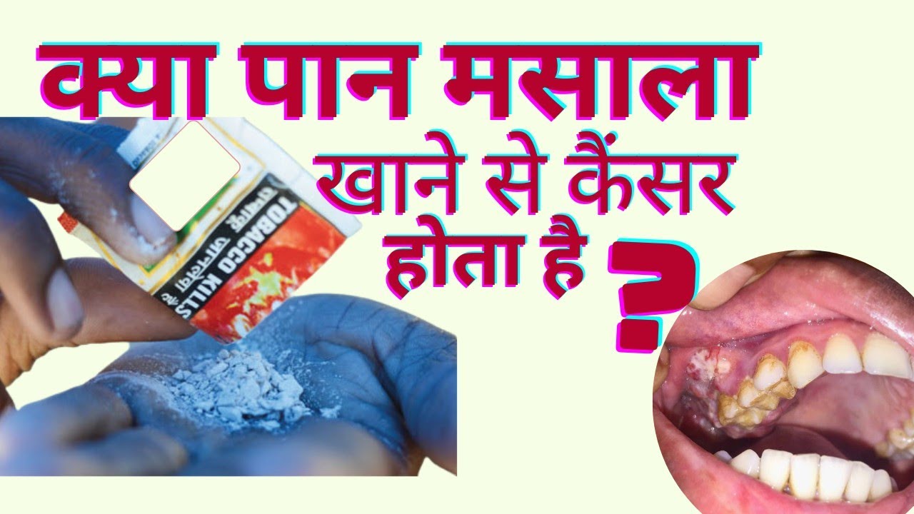 क्या वाकई पान मसाला से कैंसर होता है ?, gutkha, tambaku, pan masala ...