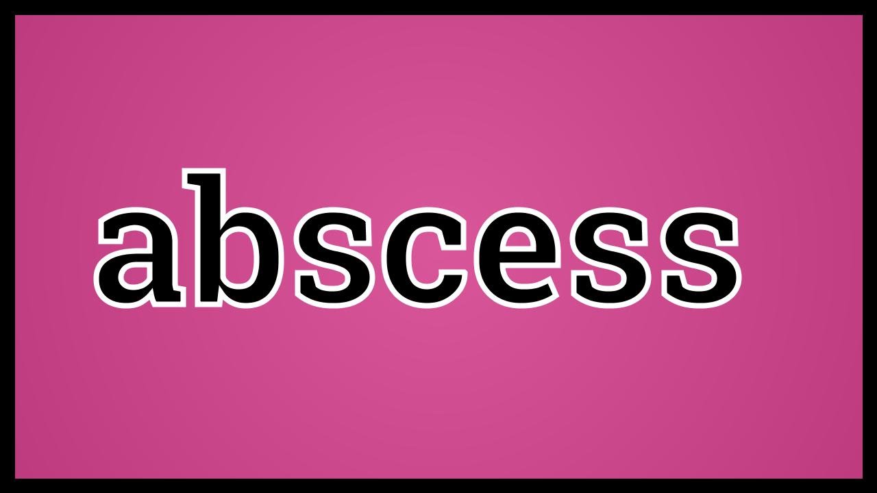 What Abscess Means YouTube what-abscess-means-youtube