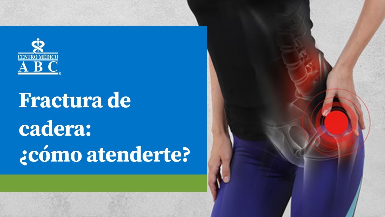 Fractura de cadera: ¿cómo atenderte? - YouTube