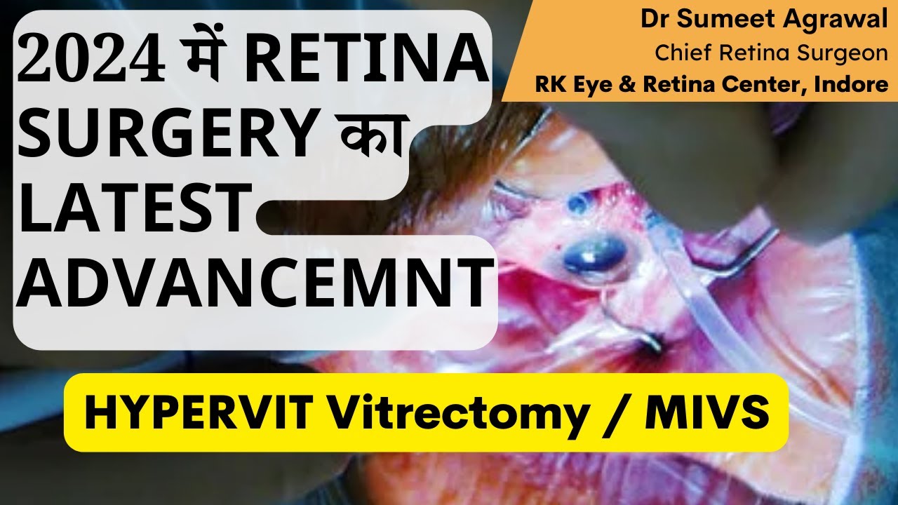 2024 में RETINA SURGERY की सबसे ADVANCED TECHNIQUE !! HYPERVIT ...
