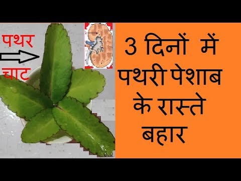kidney stone treatment in hindi for 3 day ||Home Remedies || 3 दिनों ...