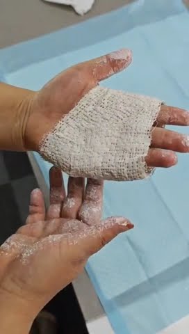 Medical POP Orthopedic Cast Bandage Disposable POP Bandage Plaster Of ...