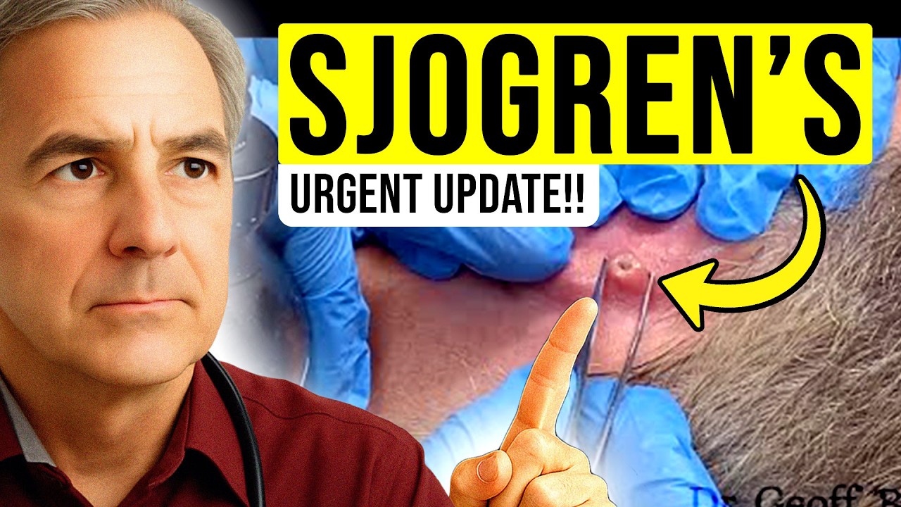 UPDATE on Sjogren's Syndrome: From Pathogeny to Treatment - YouTube