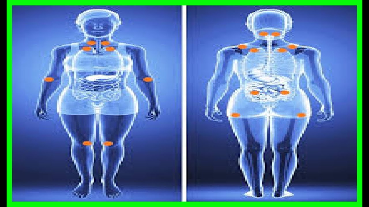 ¿Te duele en alguno de estos puntos del cuerpo Puede significar que ...