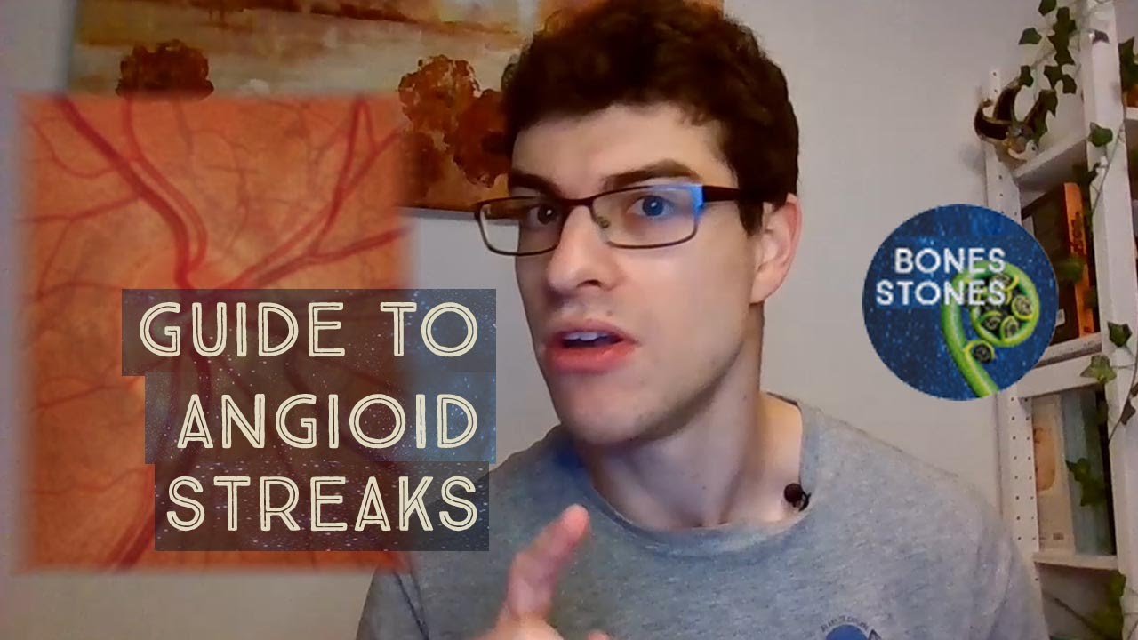 On Ophthalmology: What are angioid streaks? Why do I care? - YouTube