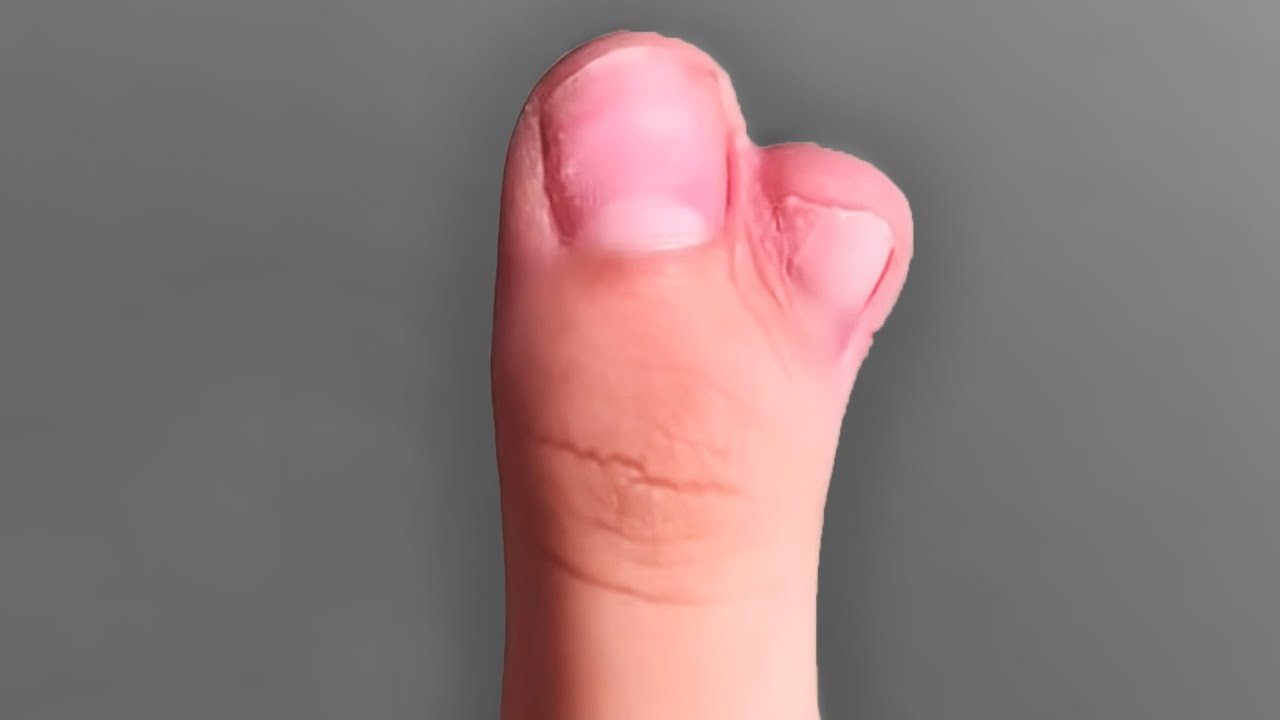 They Have an Extra Thumb - YouTube