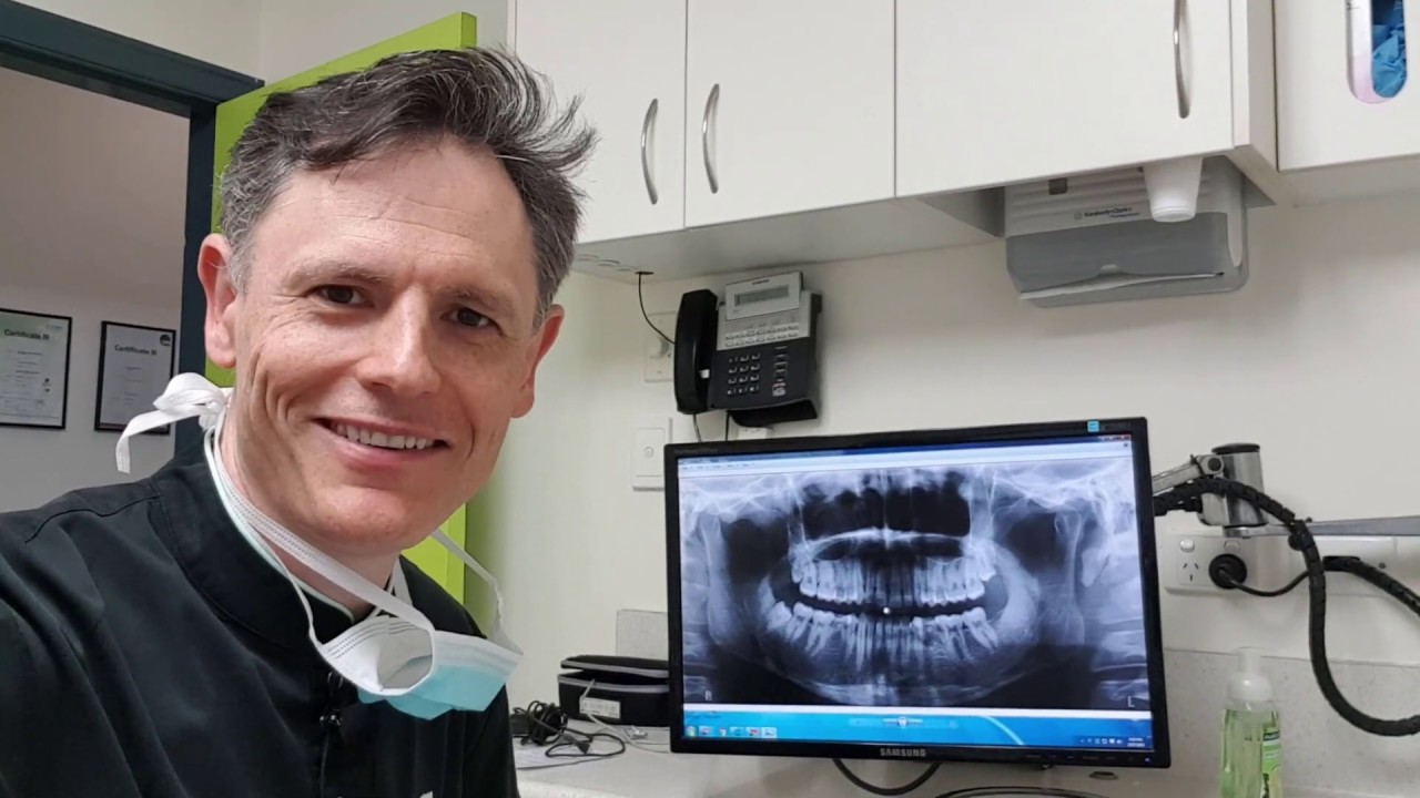 Dr Steven discusses reasons why adult tooth don't come through for some ...