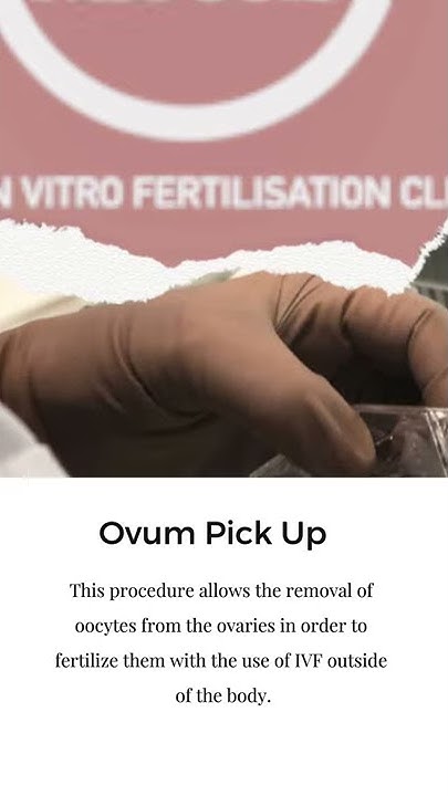 Ovum Pick Up - YouTube
