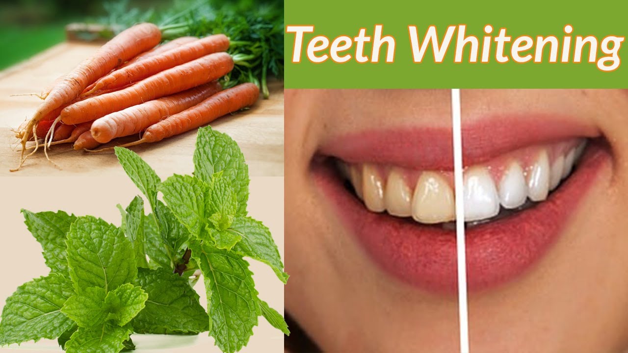 Teeth cleaning and whitening - How to whiten your yellow teeth ...