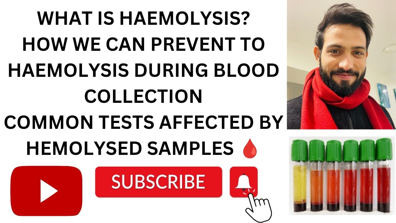 What is Haemolysis? | Tests affected by Haemolysis | #phlebotomist # ...